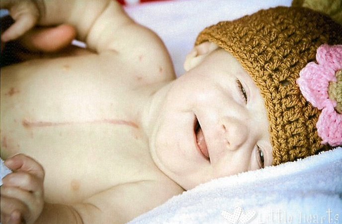 Children's Heart Federation | Pulse oximetry pilot under way