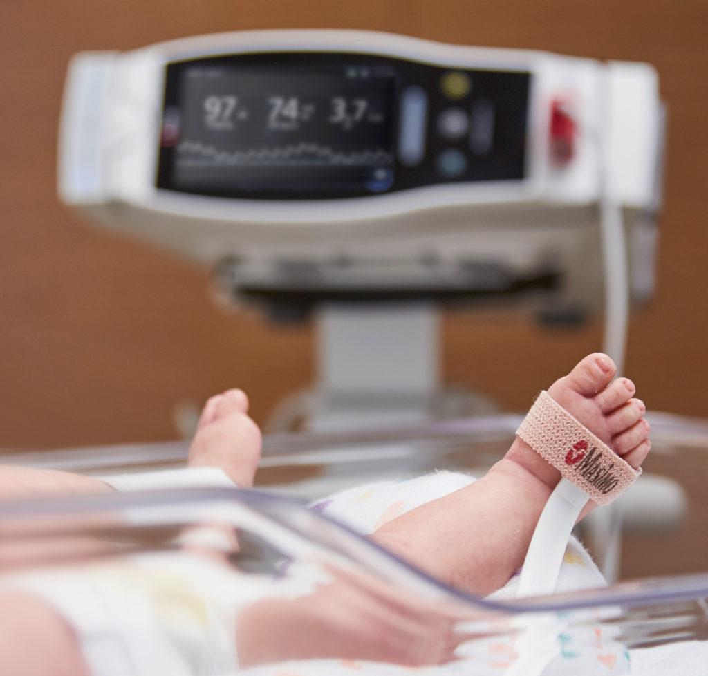 Children's Heart Federation | Pulse oximetry survey