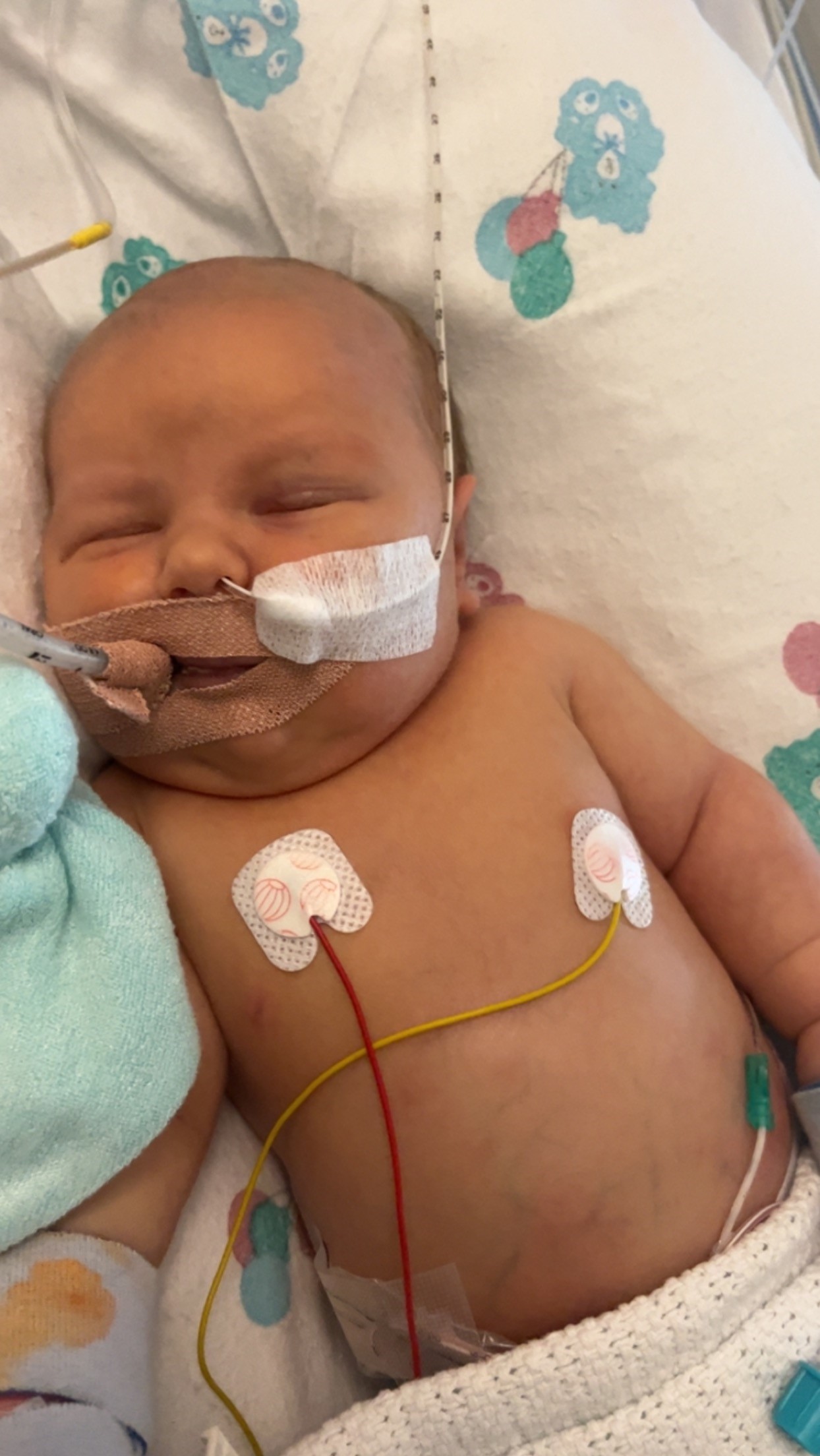 Children's Heart Federation | Kailer’s Story